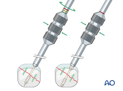 Headless compression screw insertion