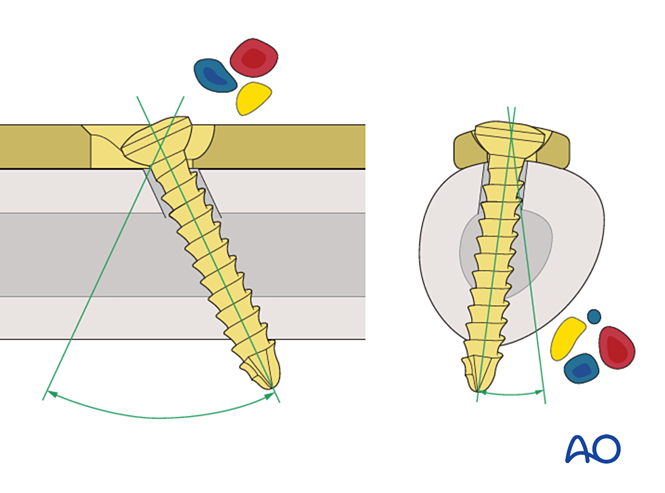 Screw insertion in neutral mode
