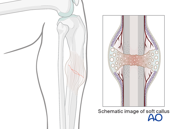 basic principles of im nailing new