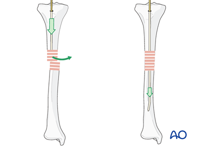 basic principles of im nailing new