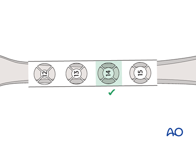basic principles of im nailing new
