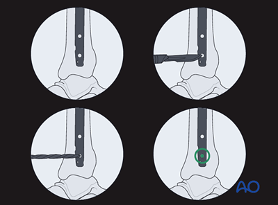 basic principles of im nailing new
