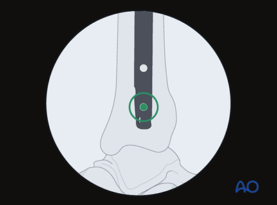basic principles of im nailing new
