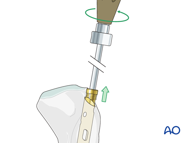 basic principles of im nailing new