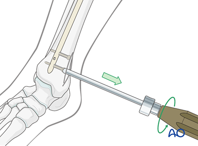 basic principles of im nailing new