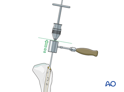 basic principles of im nailing new