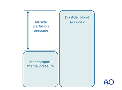 Compartment syndrome in the leg