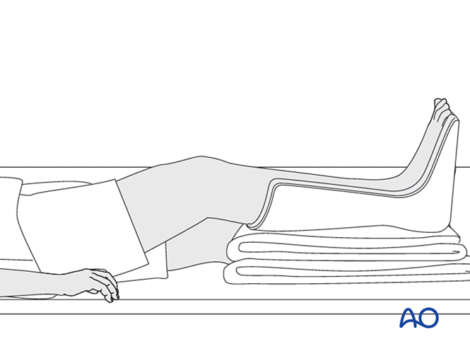 Compartment syndrome in the foot