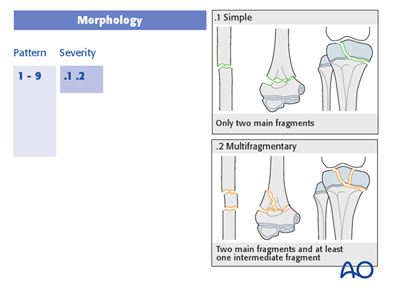 Classification of children’s fractures