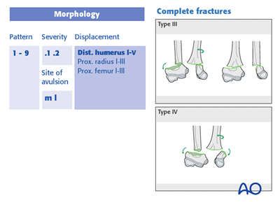 Classification of children’s fractures