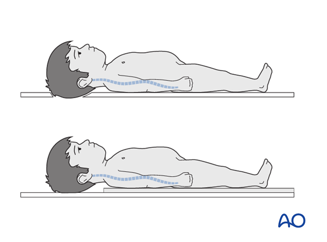 Pediatric polytrauma