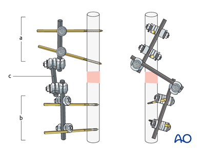 Modular external fixation
