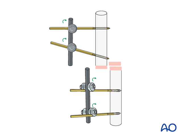 Modular external fixation