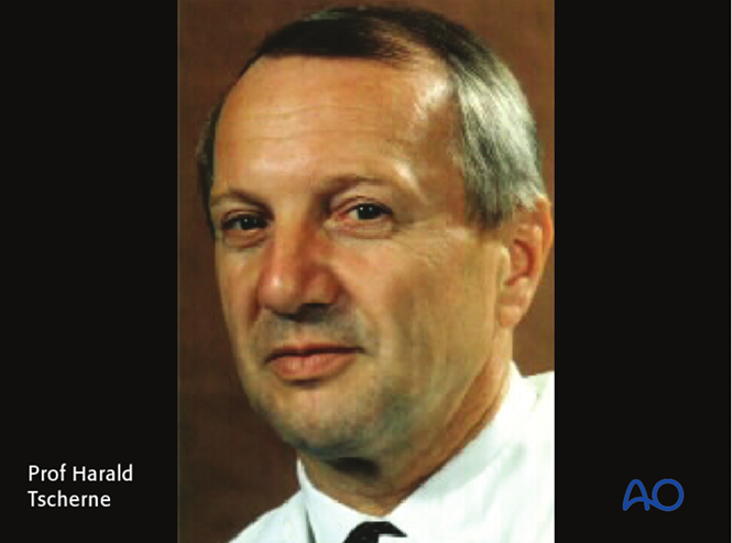 Principles of management of open fractures