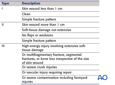 Principles of management of open fractures