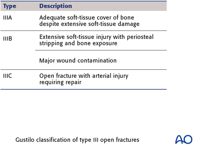 Principles of management of open fractures