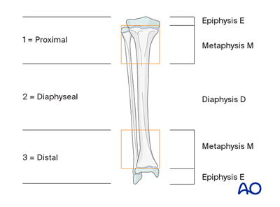 General K-wire principles