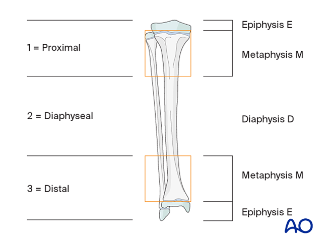 General K-wire principles