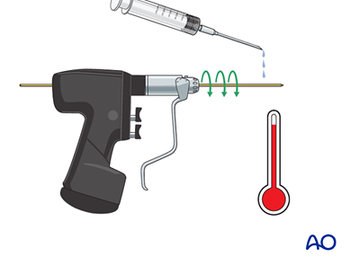 General K-wire principles
