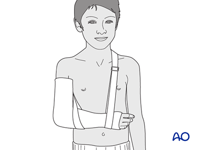 General K-wire principles