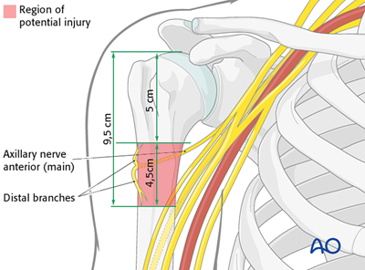 Safe zones in the humerus
