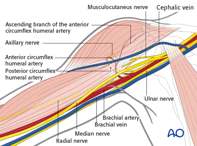 Deltopectoral approach to the proximal humerus