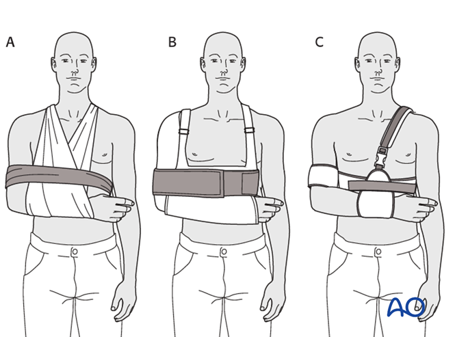 Nonoperative for Extraarticular 3-part, surgical neck and greater ...