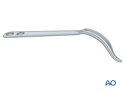 Open reduction and preliminary fixation of lesser tuberosity and ...