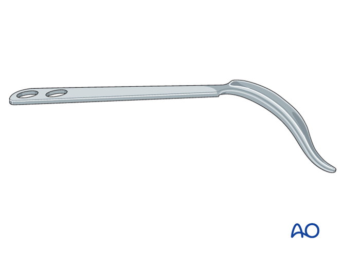 Open reduction and preliminary fixation of lesser tuberosity and ...