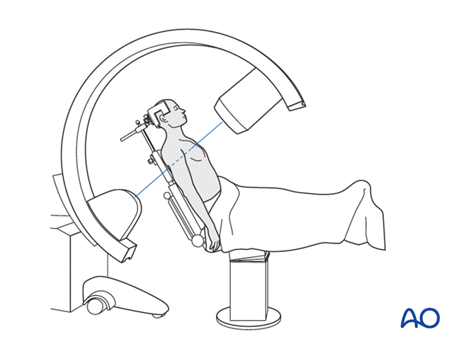 Preparation/Positioning
