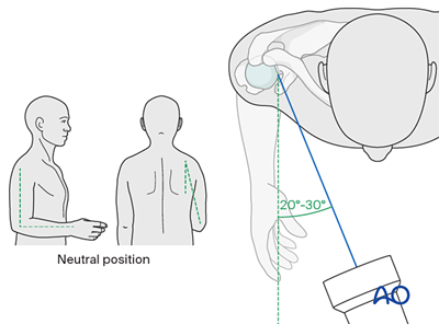 Intraoperative imaging of the proximal humerus