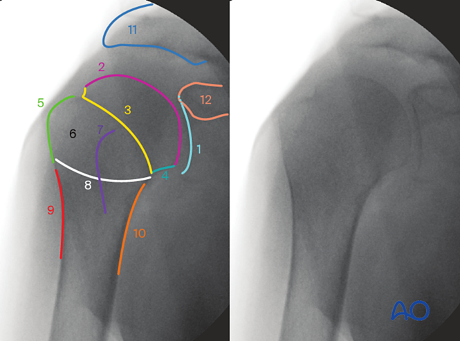 Highlights Of Intraoperative Imaging