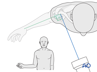 Intraoperative imaging of the proximal humerus