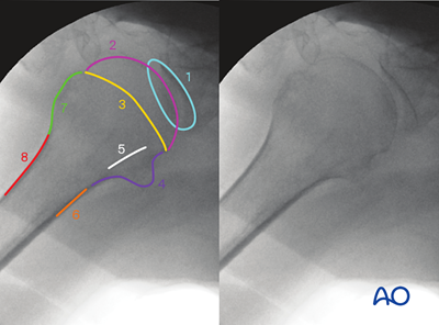 Intraoperative imaging of the proximal humerus