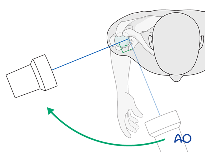 Intraoperative imaging of the proximal humerus