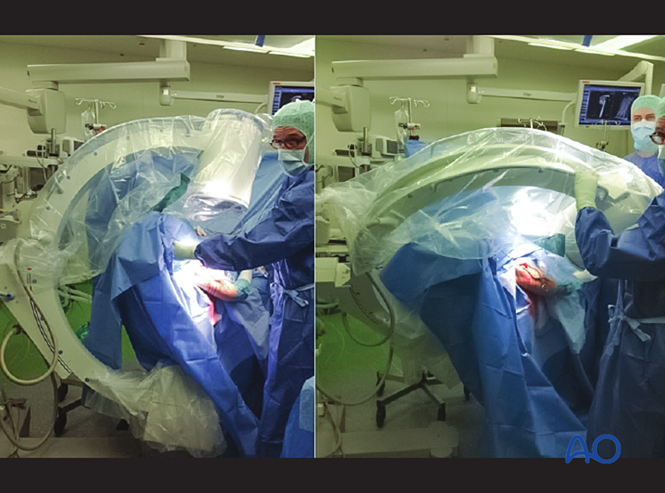 Intraoperative imaging of the proximal humerus