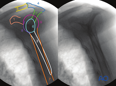 Intraoperative imaging of the proximal humerus