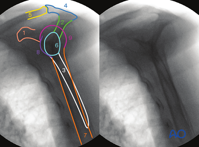 Intraoperative imaging of the proximal humerus