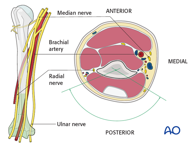 Safe zones in the humerus for percutaneous pins or screws