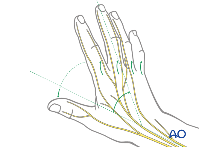 Nonoperative treatment for Simple fracture, oblique