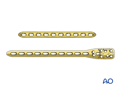 MIO - Bridge plating for Simple fracture, spiral