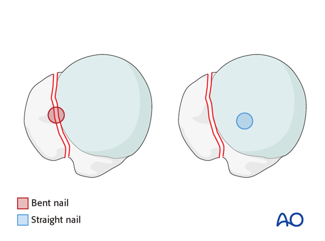 Bent vs straight nails