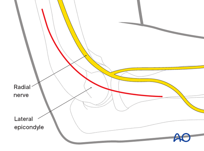 Lateral approach to the distal humerus
