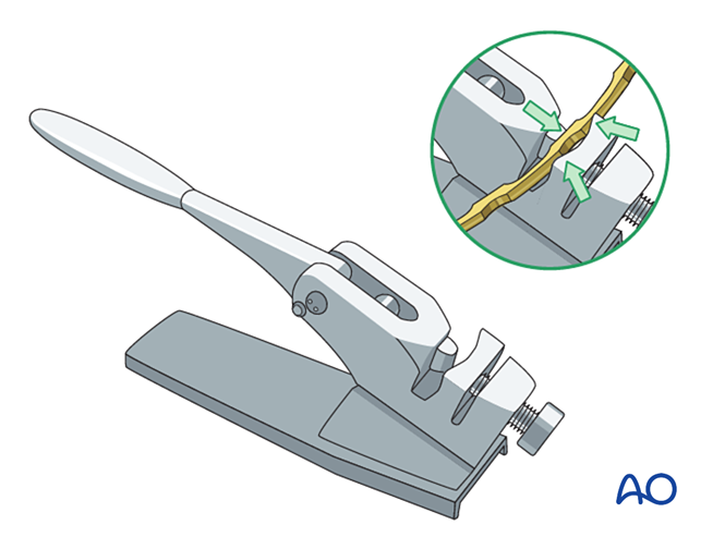 Reconstruction plates
