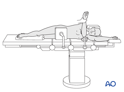 Lateral decubitus position
