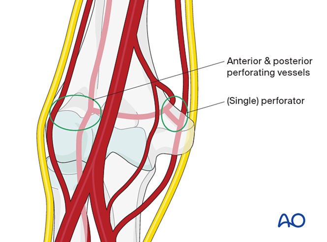 Vascularization of the distal humerus