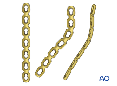 ORIF - Plate fixation for Glenoid fossa, complete articular, articular ...