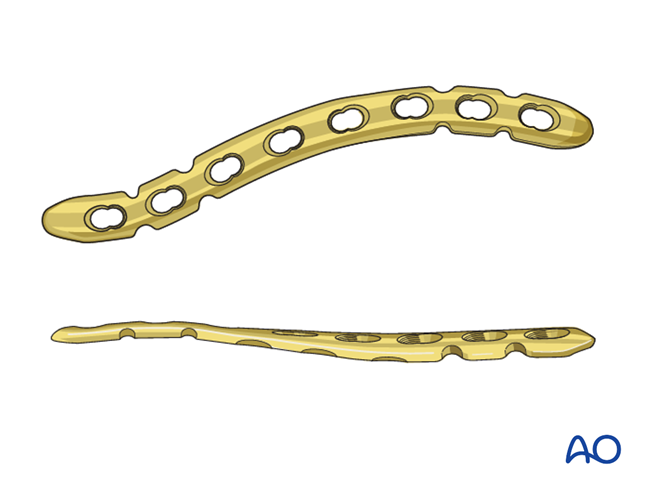 ORIF - Compression plate for Diaphyseal simple, transverse clavicle ...