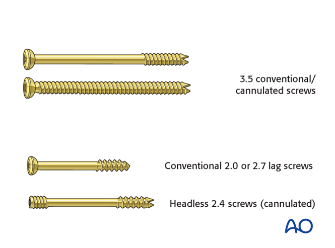 ORIF - Lag screw fixation for Glenoid fossa, partial articular ...