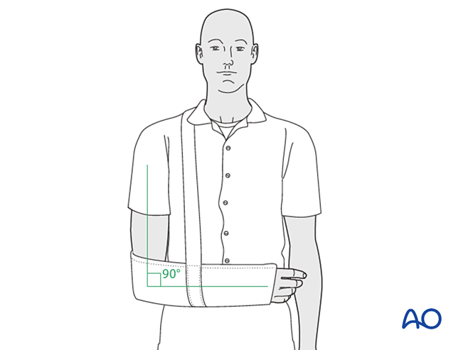 Nonoperative treatment for Body and processes, coracoid